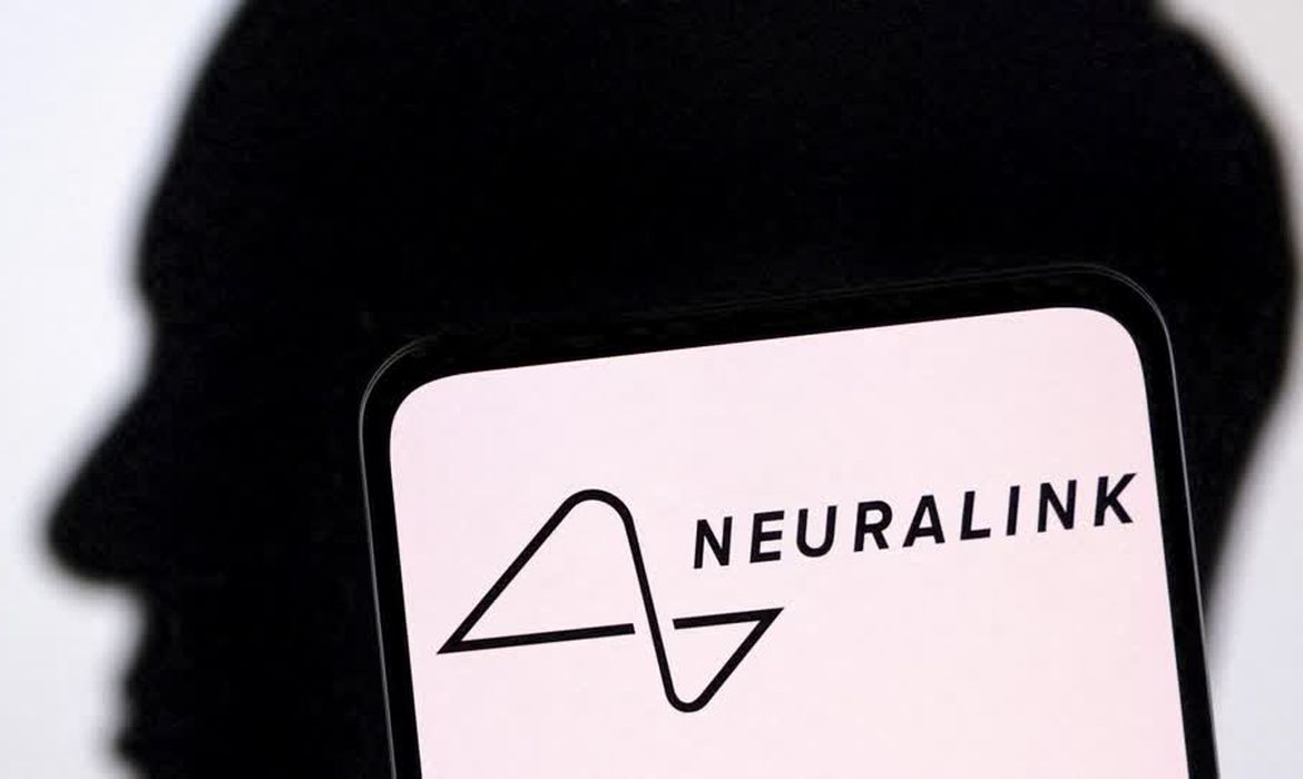 Neuralink De Elon Musk Implanta Chip Em Cérebro Humano Agência Brasil